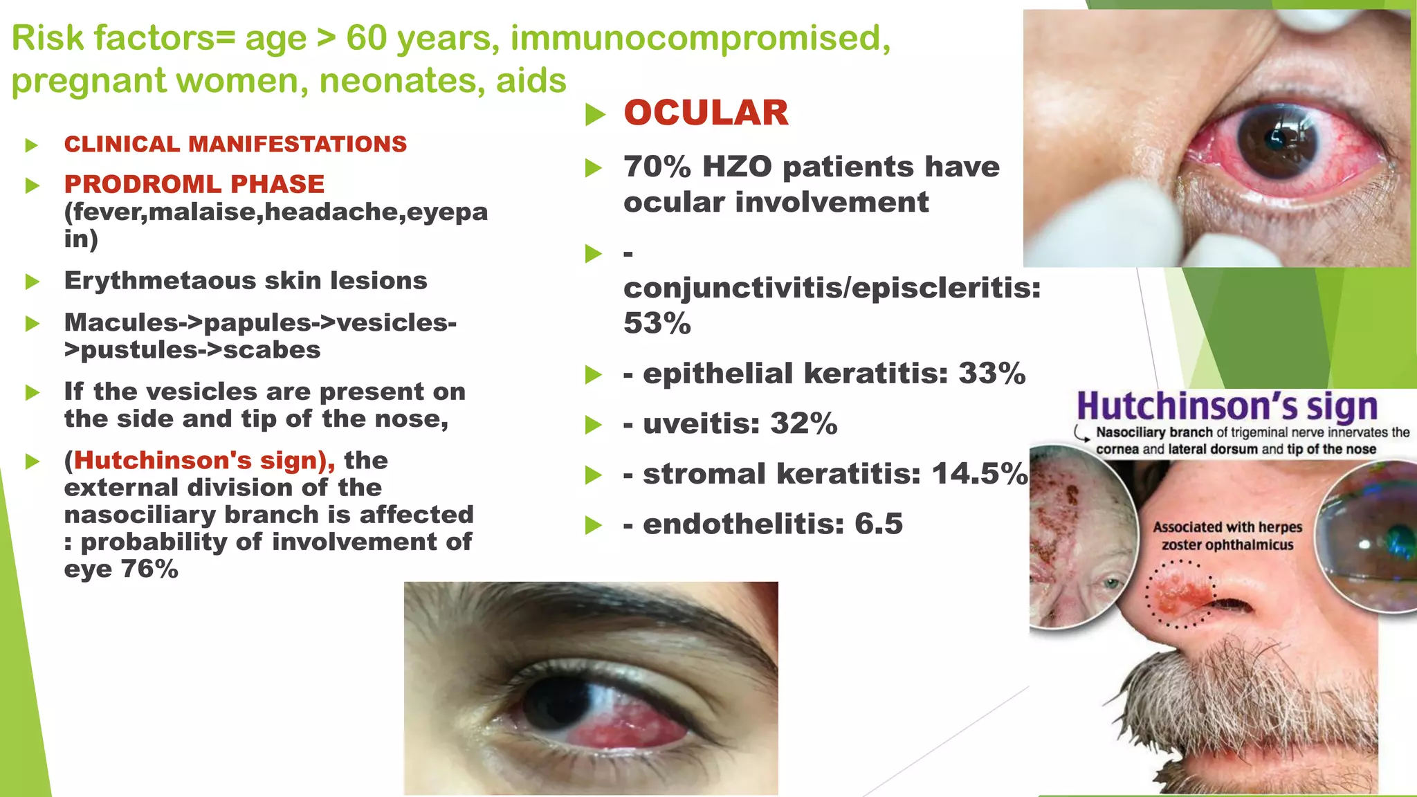 Viral Keratitis.pdf