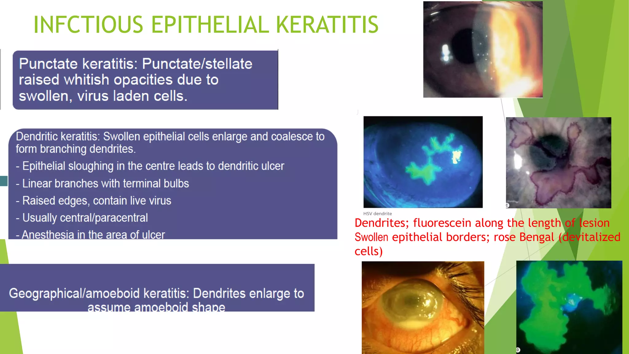 Viral Keratitis.pdf