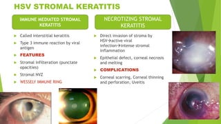 Viral Keratitis.pdf