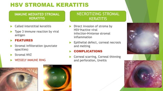 Viral Keratitis.pdf