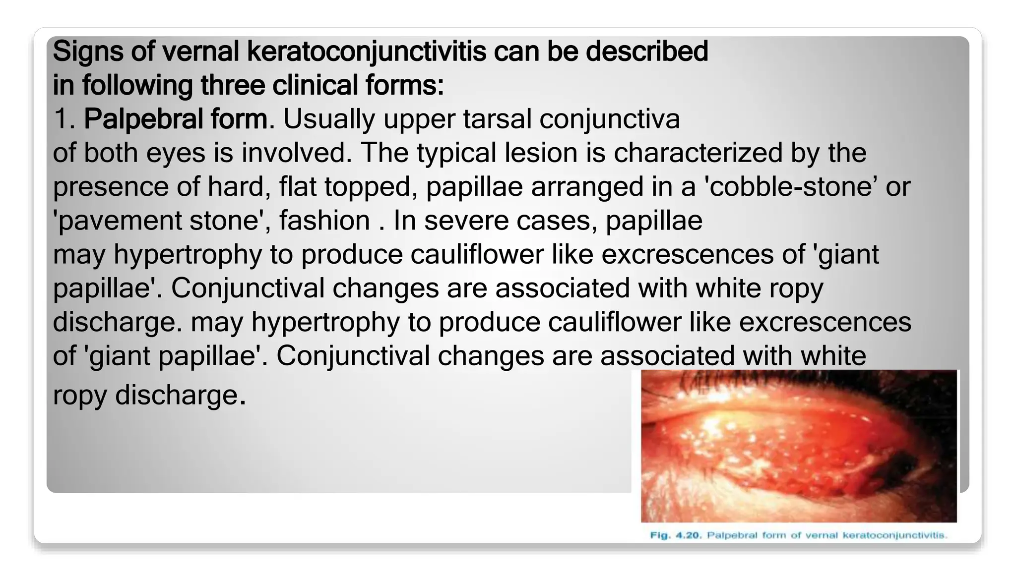 VKC by HARSHIT VERMA.pptx conjunctivitis | PPTX