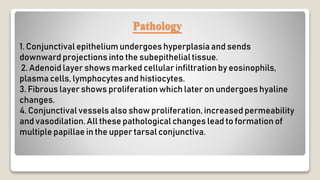 VKC by HARSHIT VERMA.pptx conjunctivitis | PPTX