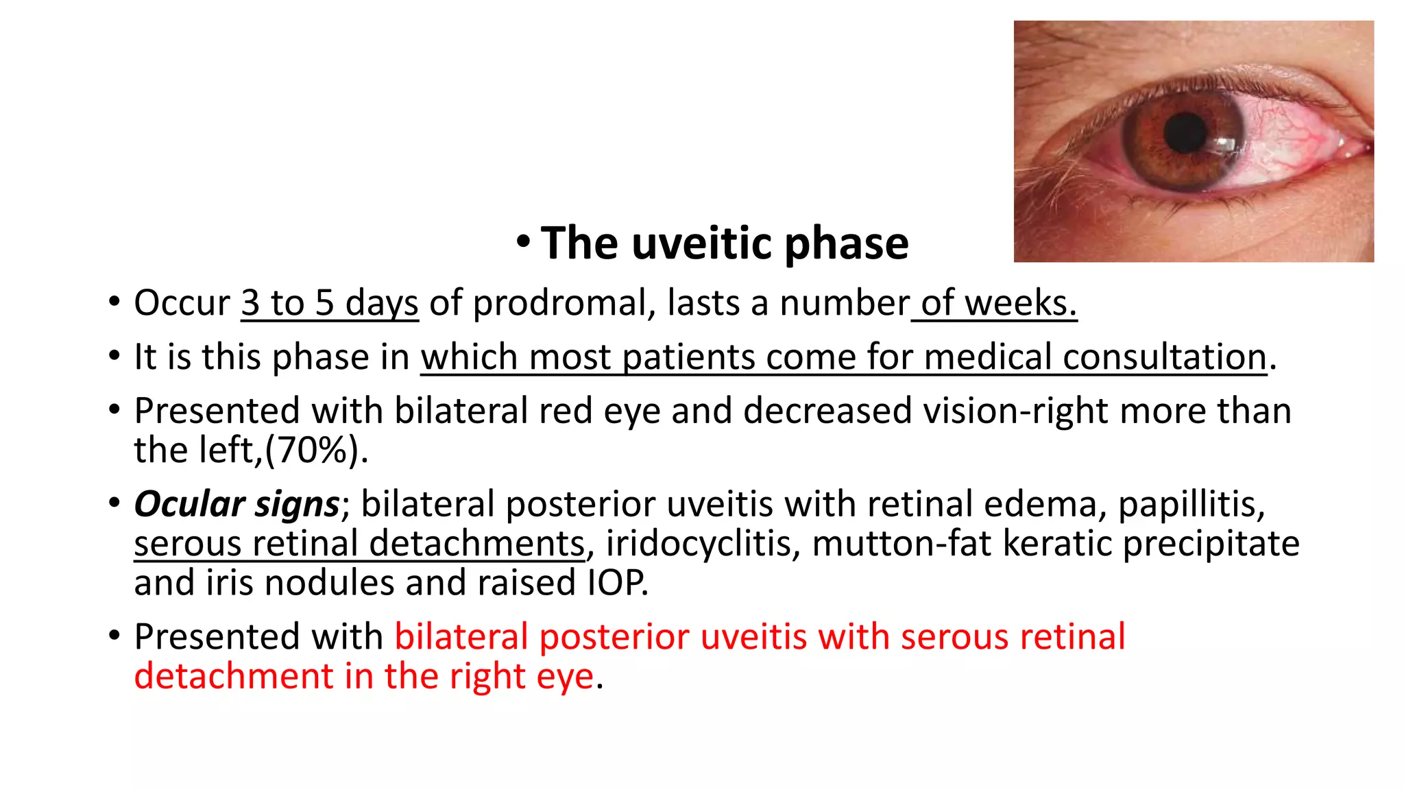 Vogt-Koyanagi-Harada (VKH) syndrome | PPTX