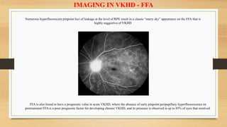 VKHD presentation.pptx | Eye and Vision Conditions | Diseases and ...