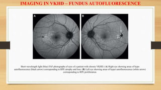 VKHD presentation.pptx