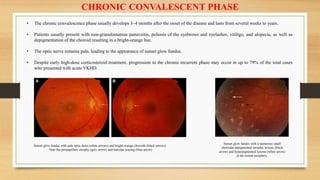 VKHD presentation.pptx | Eye and Vision Conditions | Diseases and ...