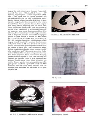 Successful management of massive intra-operative pulmonary embolism ...