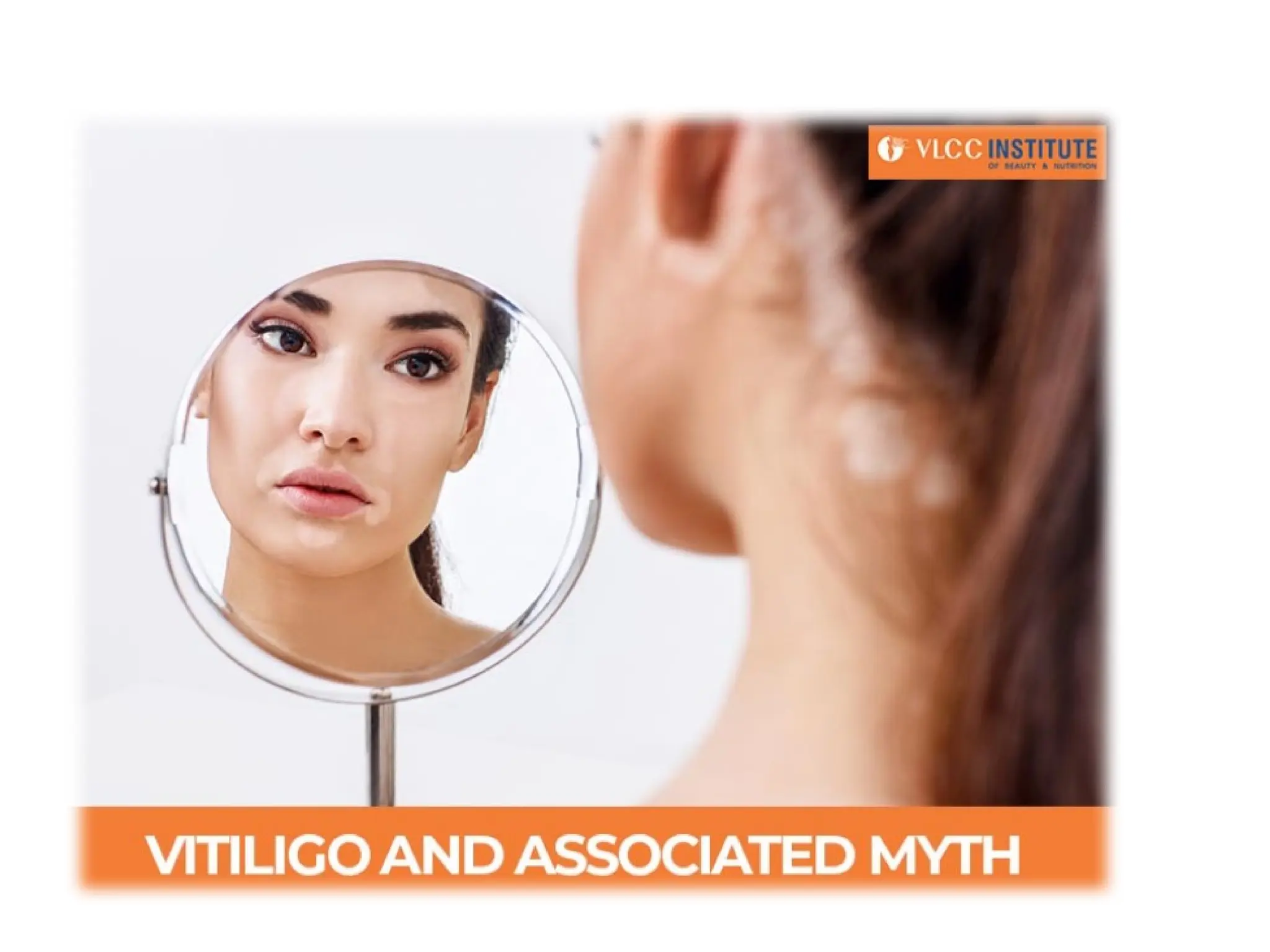 Vlcc School Vitiligo and Associated Myth | PPT