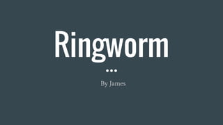 Ringworm | PPTX