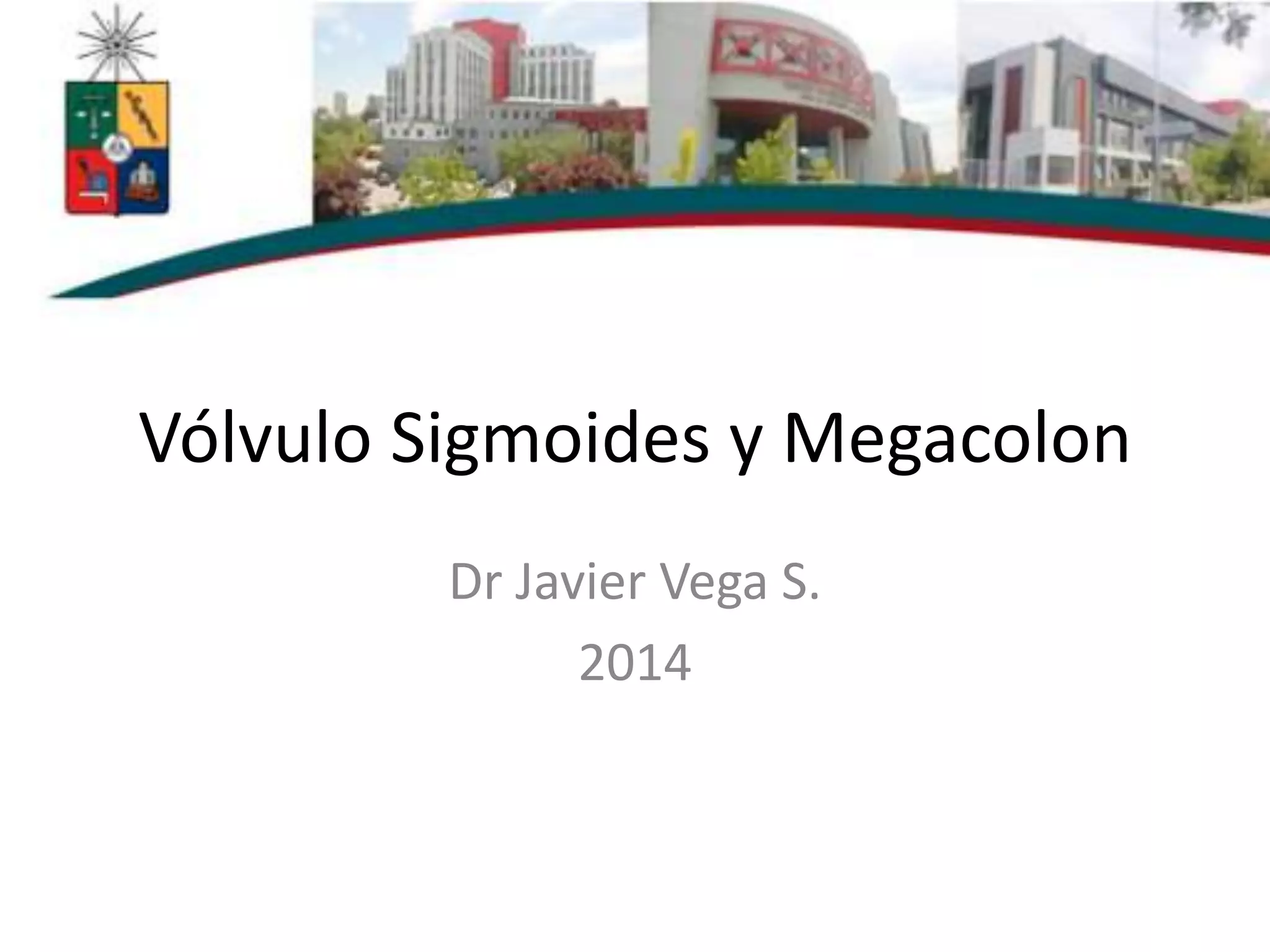Vólvulo sigmoides y megacolon | PPTX