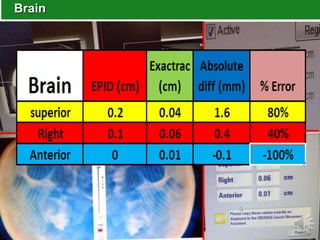 Vmat technique for Breast, Head and Neck, Brain and Craniospinal ...