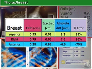 Vmat technique for Breast, Head and Neck, Brain and Craniospinal ...