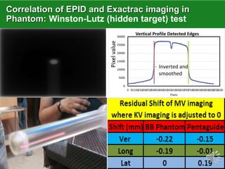 Vmat technique for Breast, Head and Neck, Brain and Craniospinal ...