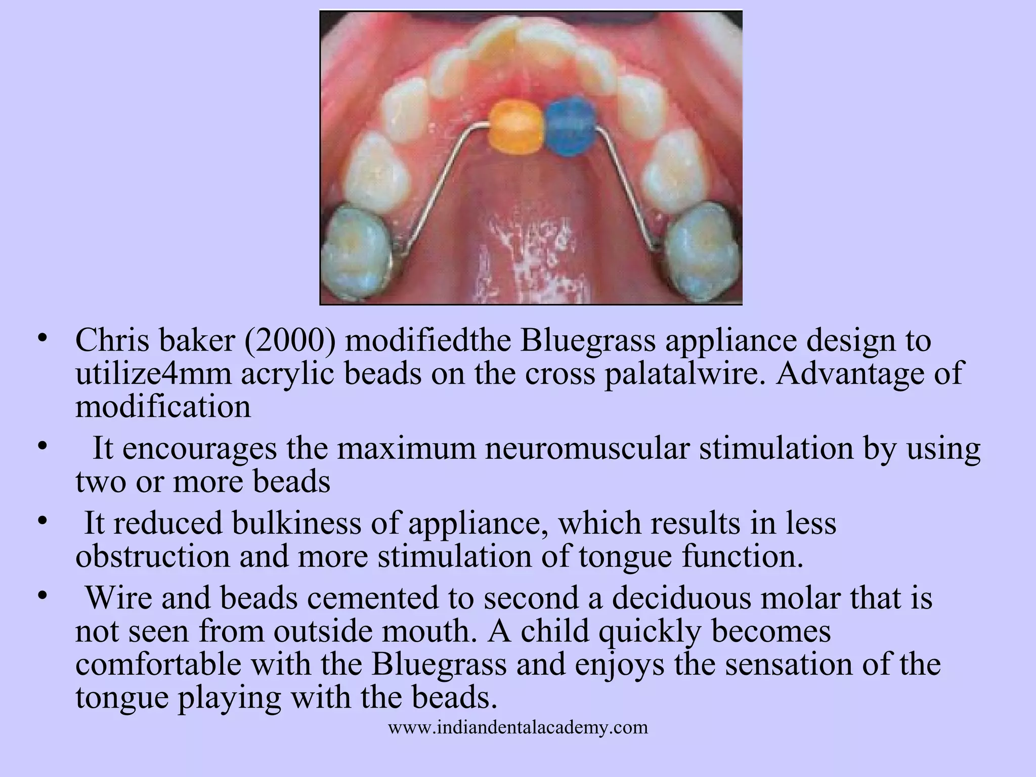 Vertical maxillary excess | PPT