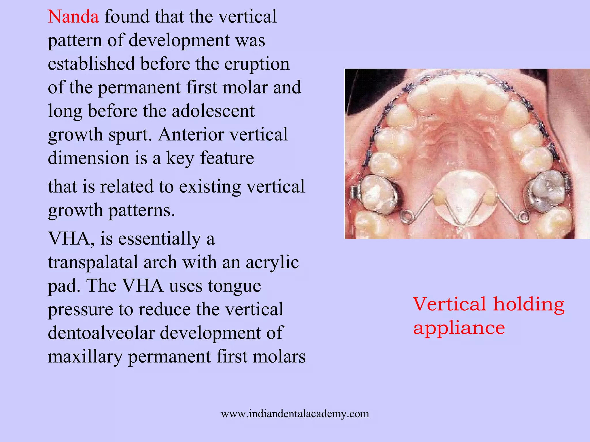 Vertical maxillary excess | PPT