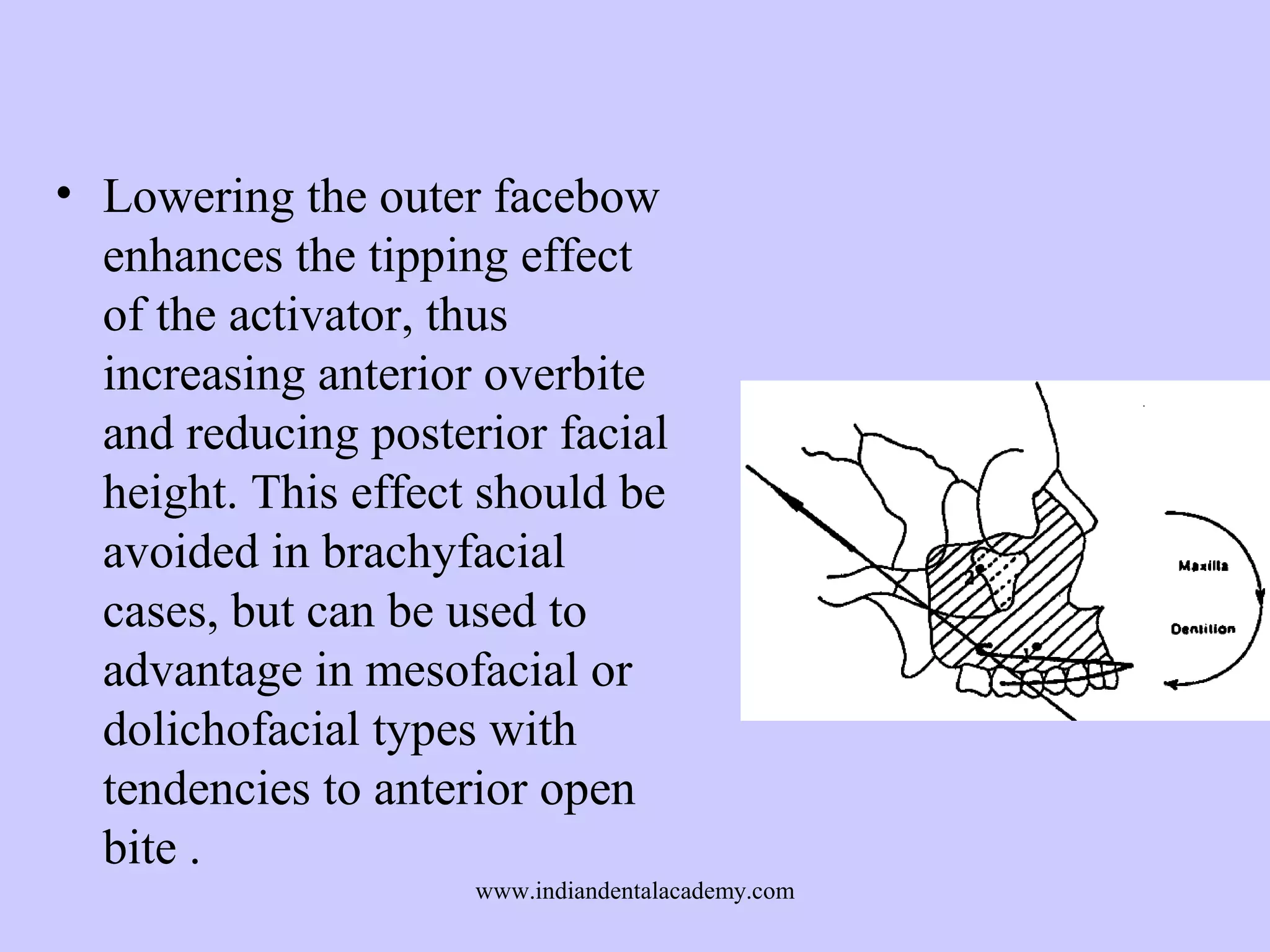 Vertical maxillary excess | PPT