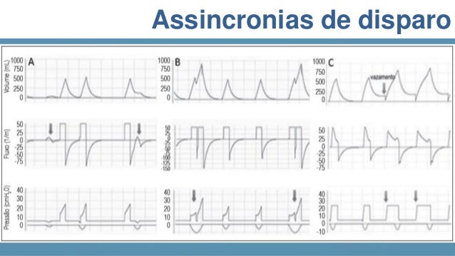 Ventilação Mecânica 2013: Princípios Básicos