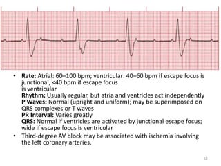 Heart blocks slide for pharmacy and study | PPT