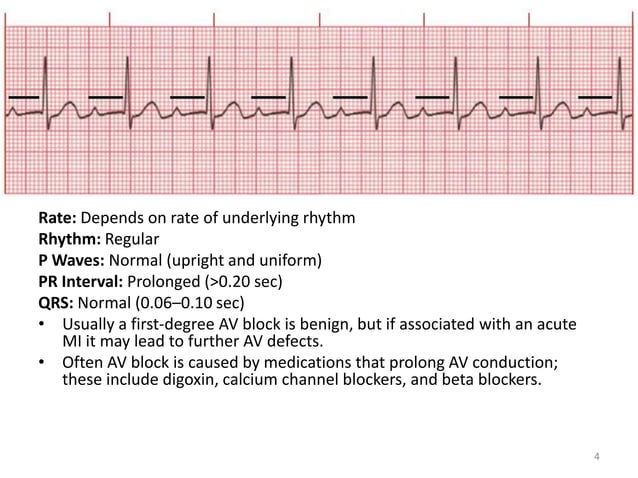 Heart blocks slide for pharmacy and study | PPT