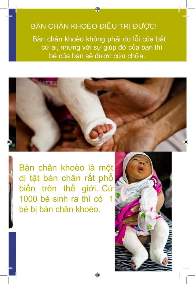 Vn clubfoot-patient-information-book | PDF