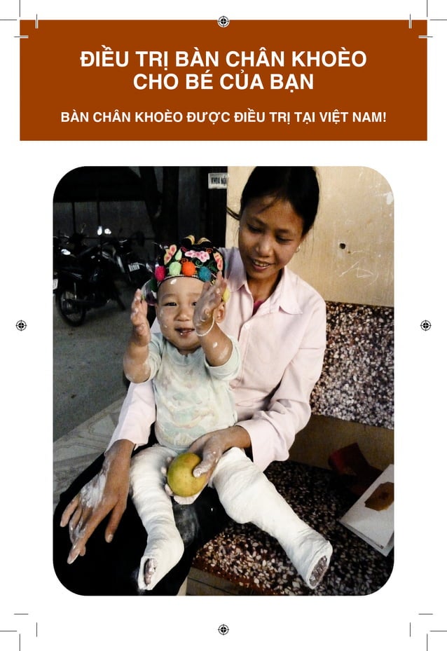 Vn clubfoot-patient-information-book | PDF