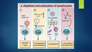 COVID-19 Immunopathogenesis – PPT & pdf file | PPT