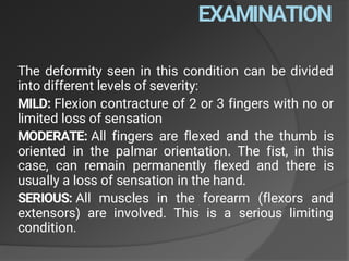 Volkman ischamic contracture | PDF