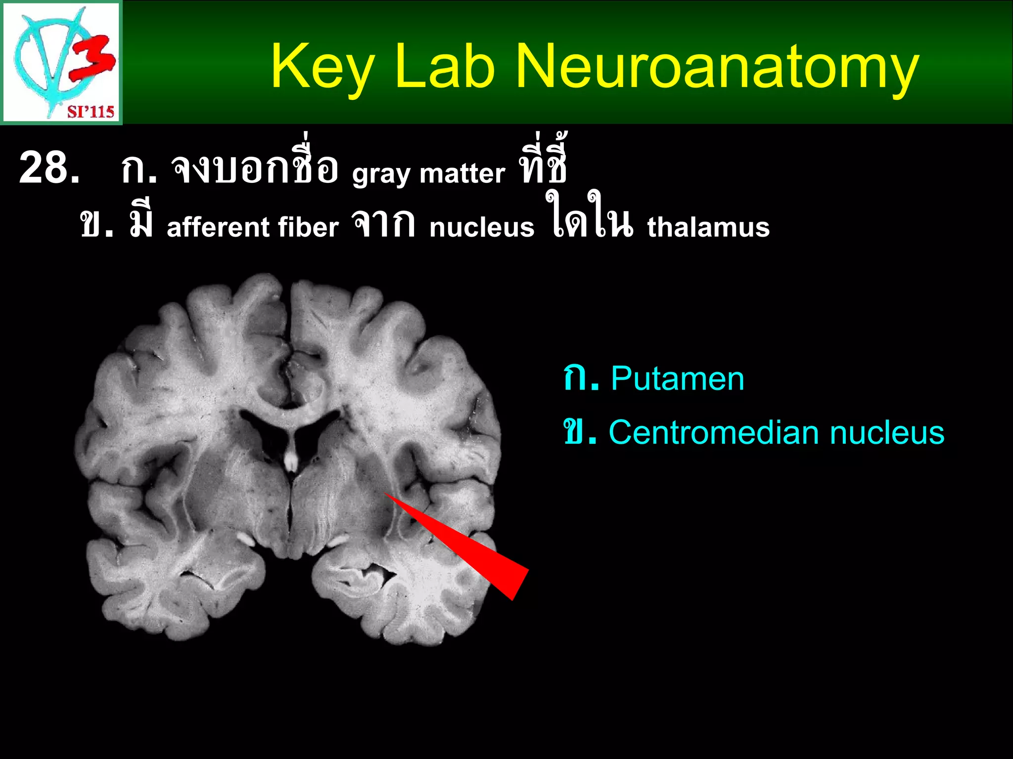V Neuroanatomy Iii Key Section | PPT | Free Download