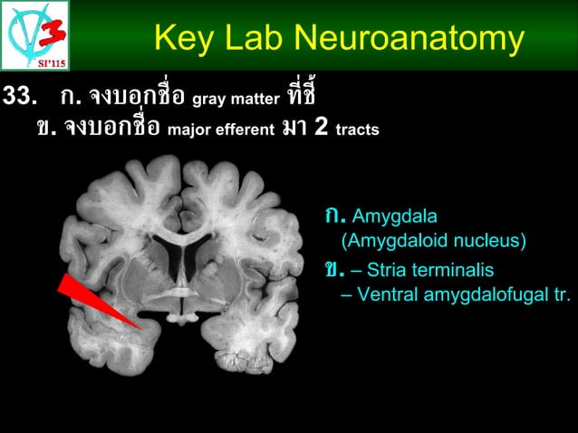 V Neuroanatomy Iii Key Section | PPT