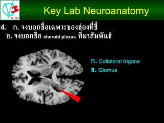 V Neuroanatomy Iii Key Section | PPT