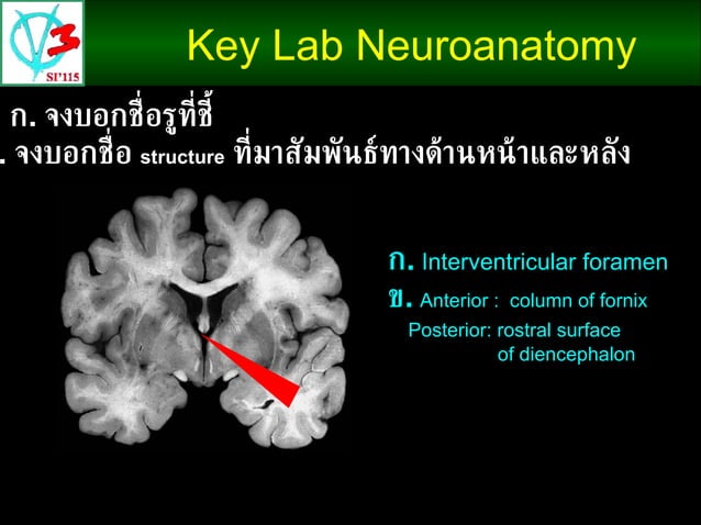 V Neuroanatomy Iii Key Section | PPT | Free Download