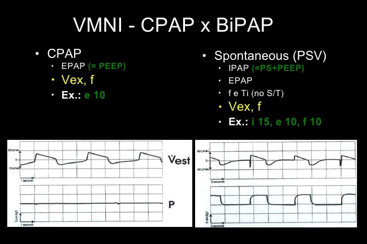 VNI no intraooperatorio