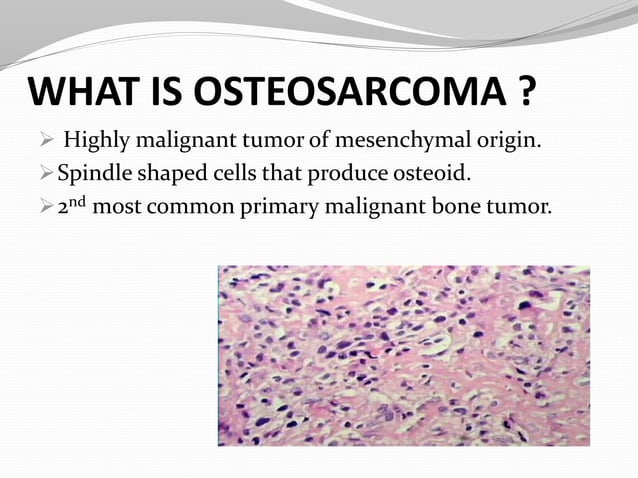 osteosarcoma | PPT