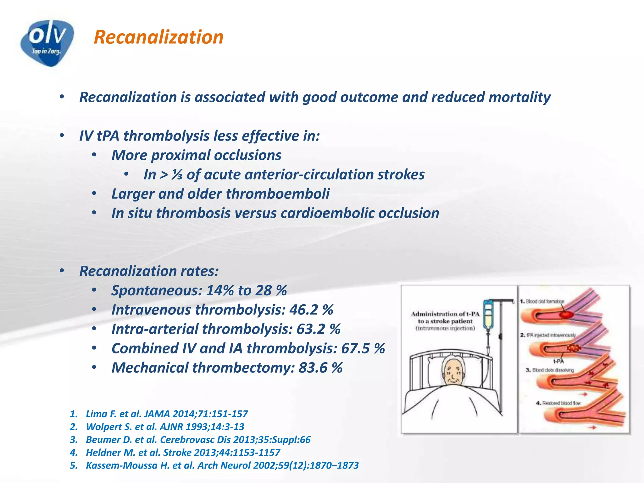 Stroke & thrombectomy - Dr. Jo Caekebeke | PPTX