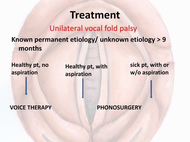 APPROACH TO A PATIENT WITH VOCAL CORD PARALYSIS