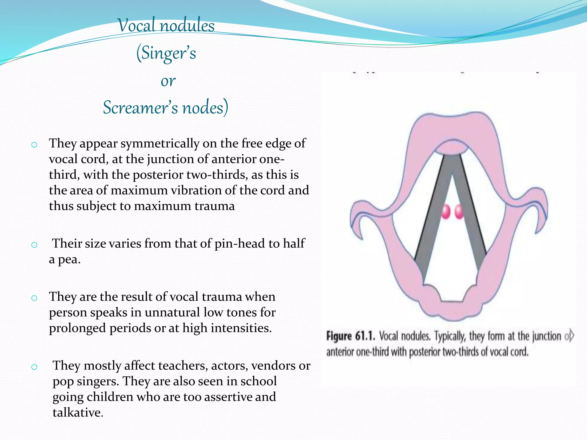Vocal cord nodule | PPTX