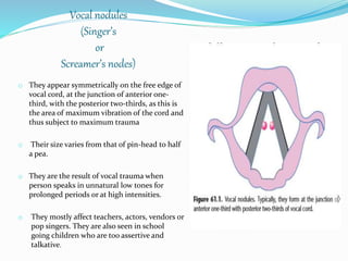 Vocal cord nodule | PPTX