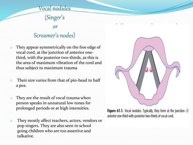 Vocal cord nodule | PPTX | Ear, Nose and Throat Conditions | Diseases ...