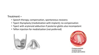 Vocal cord palsy | PPTX