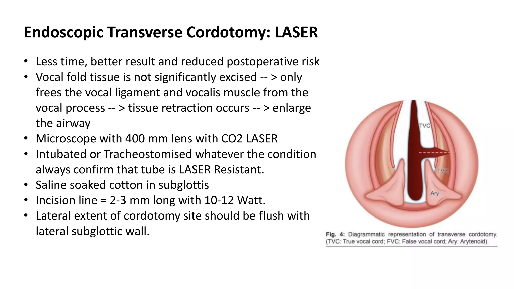 Vocal cord palsy | PPTX
