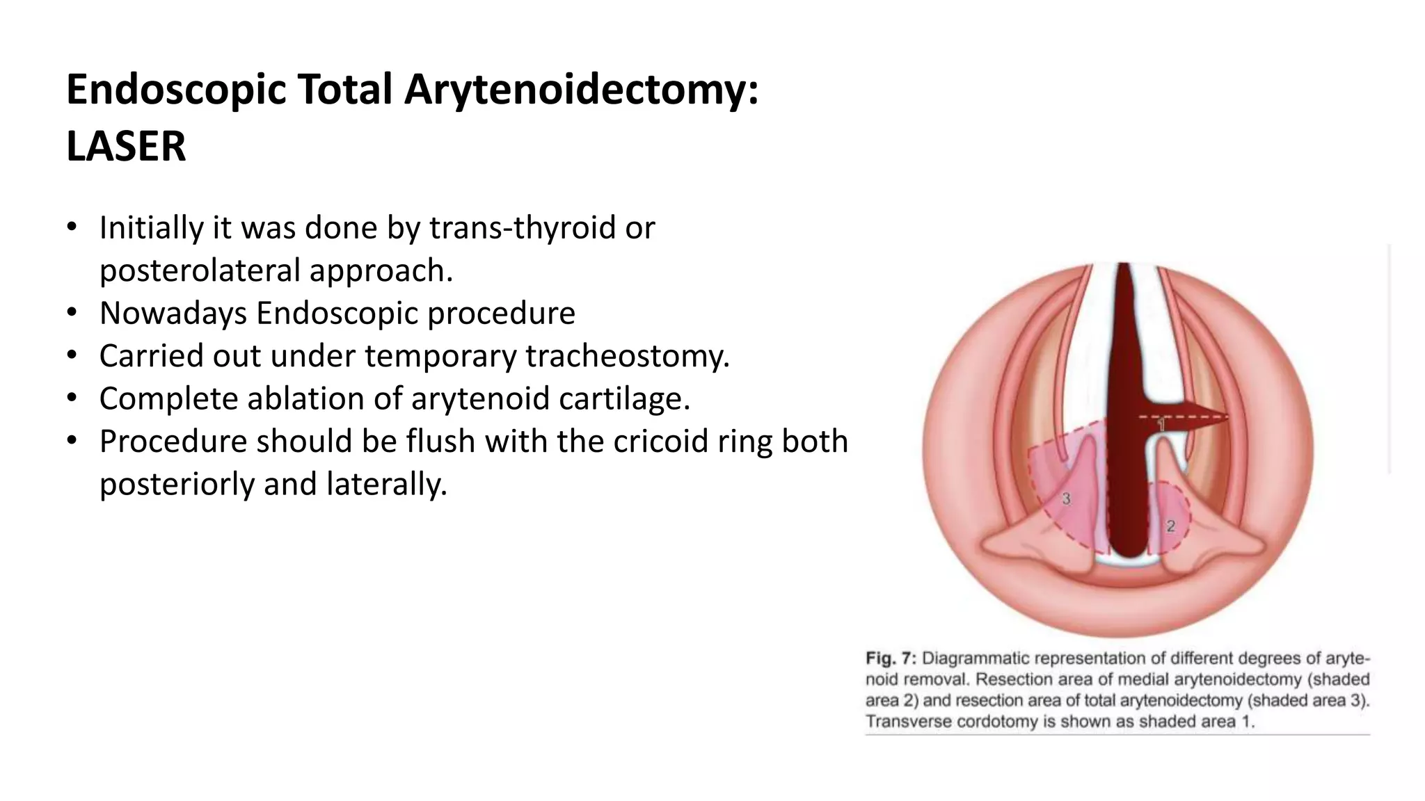 Vocal cord palsy | PPTX