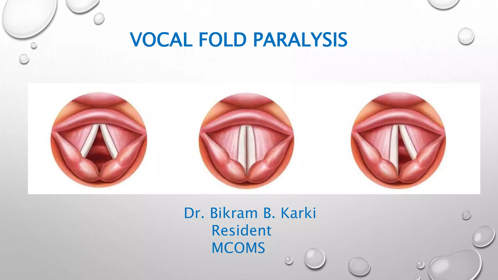 Vocal cord paralysis | PPTX