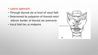 Vocal cord paralysis | PPTX