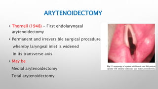 Vocal cord paralysis | PPTX