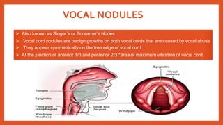 VOCAL NODULE AND HORSENESS.pptx | Thyroid Disorders | Endocrine and ...
