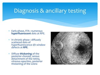 Vogt koyanagi-harada disease | PPTX