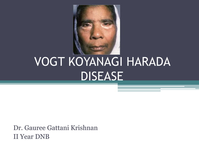 Vogt Koyanagi Harada Disease | PPTX | Eye and Vision Conditions | Diseases and Conditions
