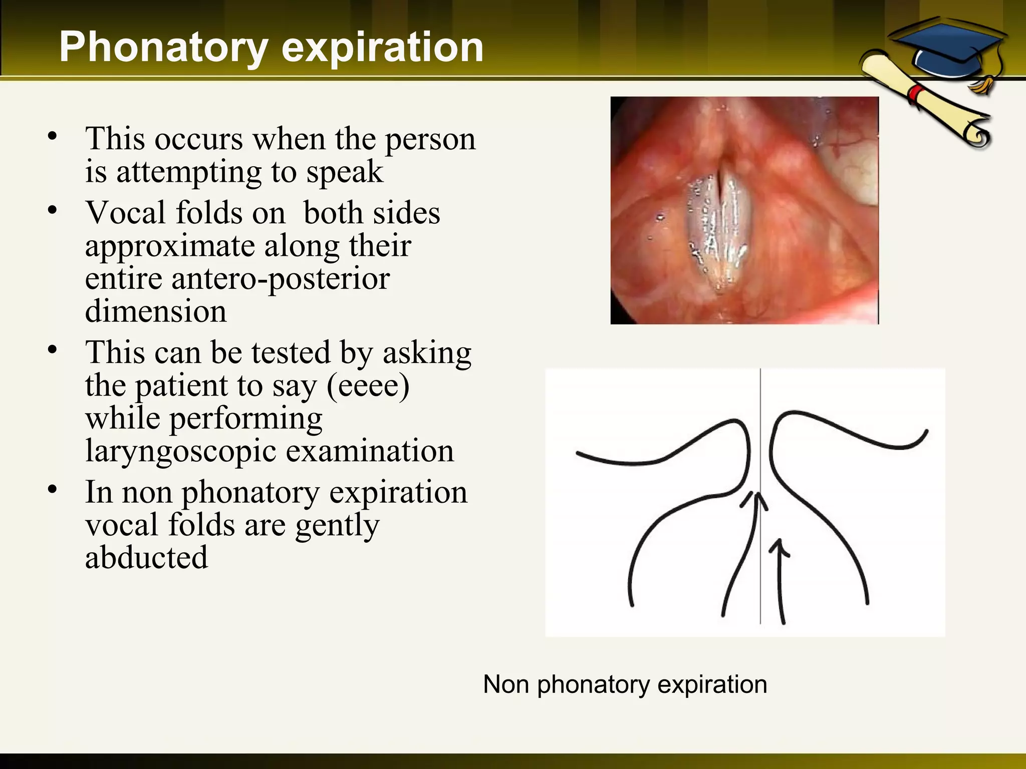 Voice disorders | PPT