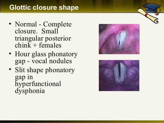 Vocal Fold Disorders