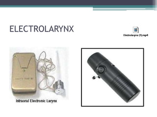 voice rehabilitation in total laryngectomy | PPTX